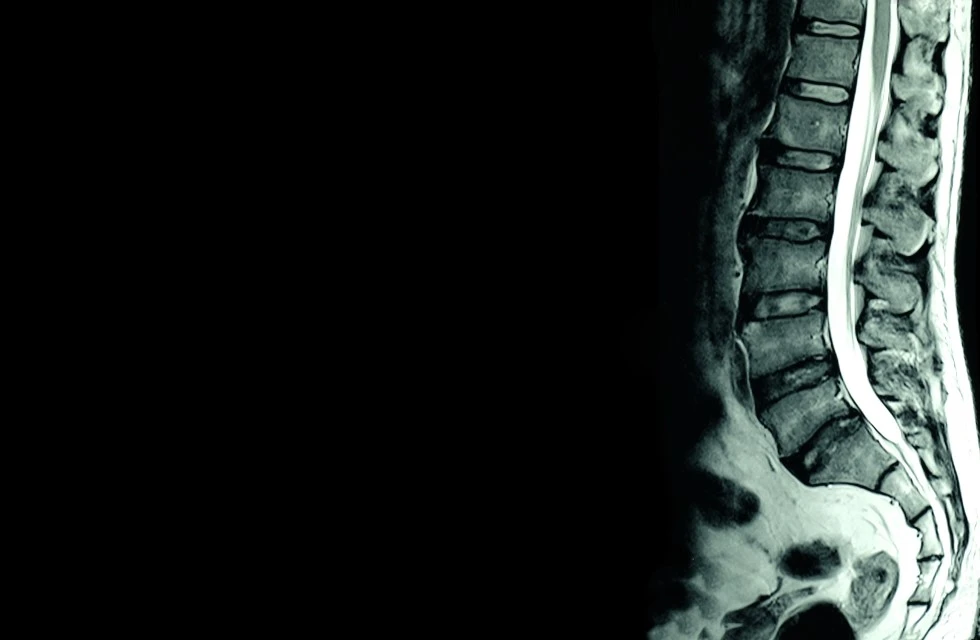 What is Bulbocavernosus Reflex And How It Is Performed?